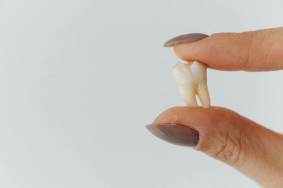 Clayton South Dental Fillings - Clayton South Dental
